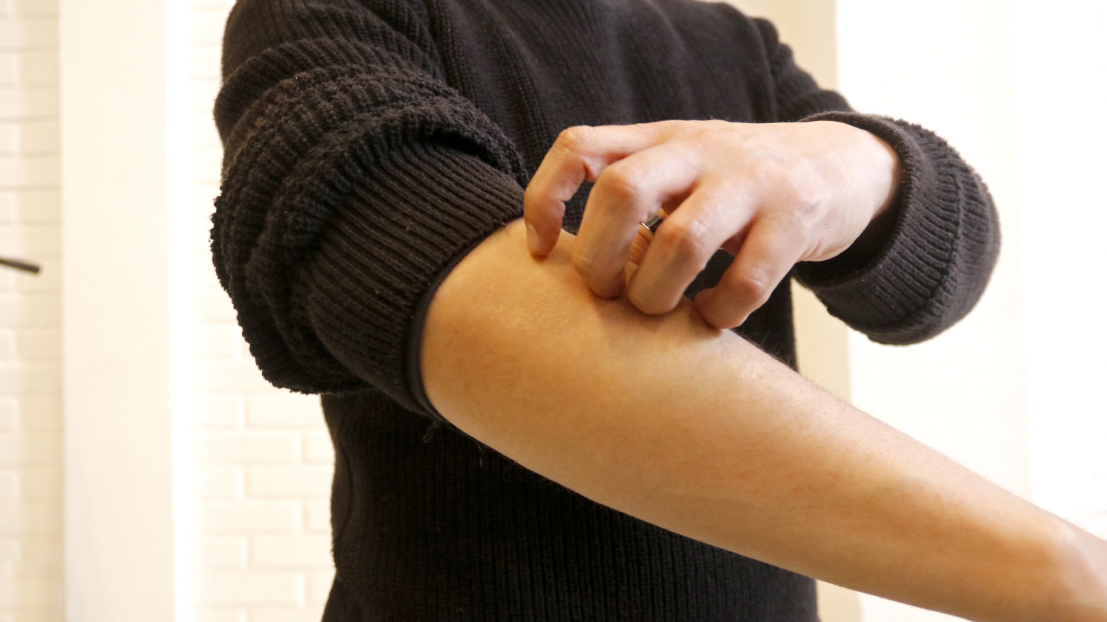 ¿Qué es un brote epidemiológico? - Mi Seguridad